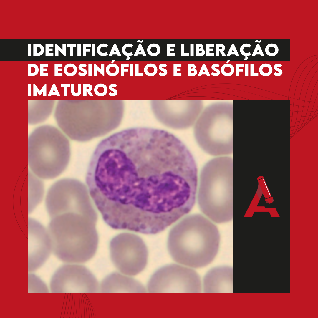 Identificação e liberação de eosinófilos e basófilos imaturos - Blog ...