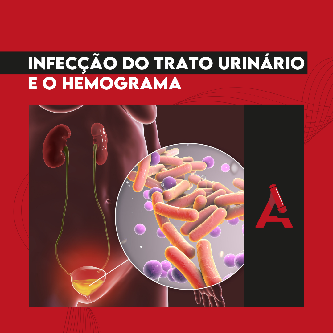 Infecção do Trato Urinário e o Hemograma - Blog - Atlas em Hematologia